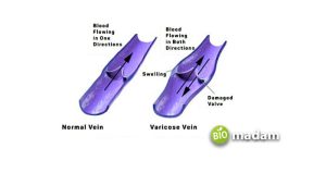 Difference Between Arteries and Veins - biomadam