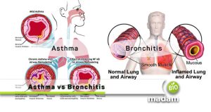 Difference Between Asthma And Bronchitis - biomadam