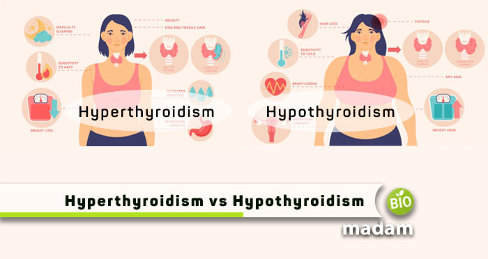 Difference Between Hyperthyroidism And Hypothyroidism Biomadam