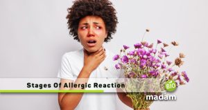 Stages of Allergic Reaction - biomadam