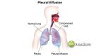 Difference between Diffusion and Effusion - biomadam