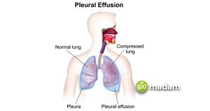 Difference between Diffusion and Effusion - biomadam