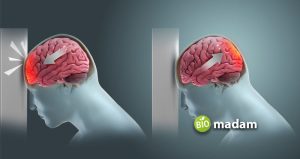 Functions of the Brain Stem - biomadam