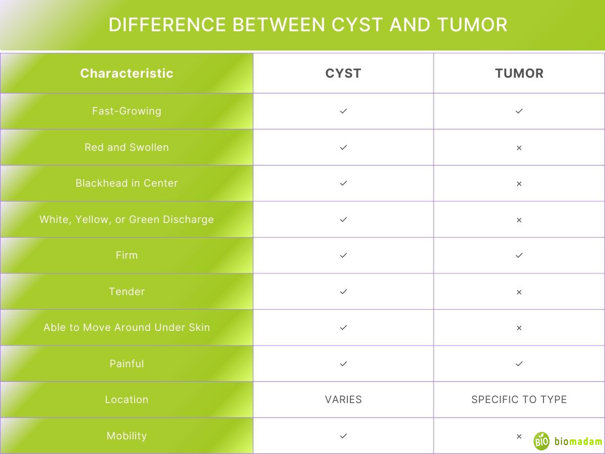 Difference Between Breast Cyst And Tumor – JRYE