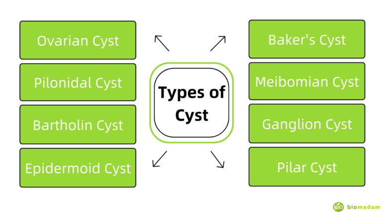 Difference Between Cyst and Tumor - biomadam